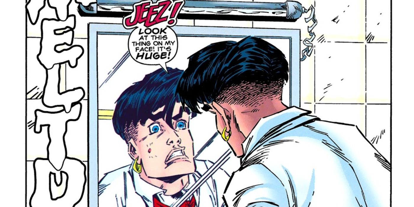 Superboy: How the Young Justice Hero Was Almost Killed by a… PIMPLE?!